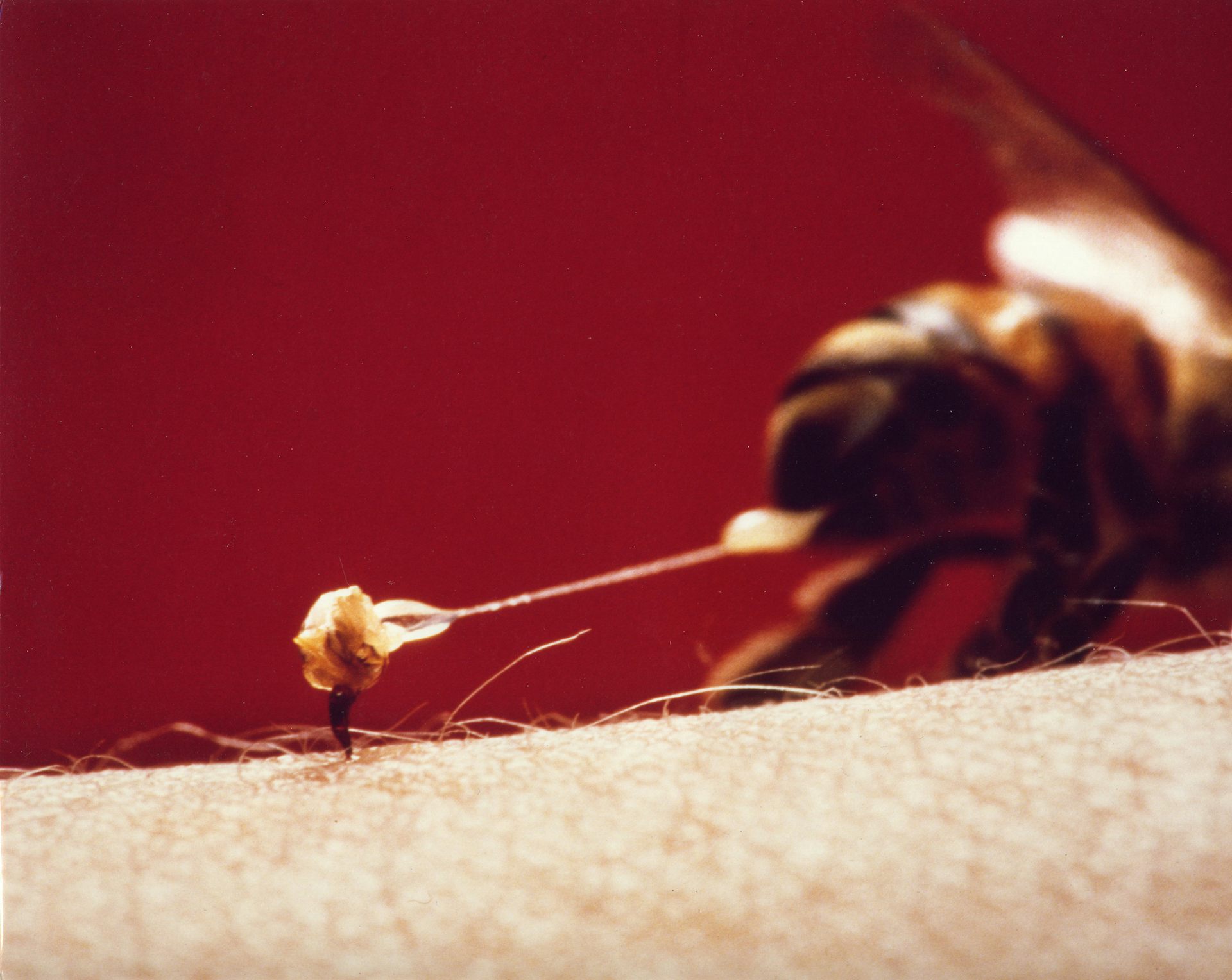 Suffering for science: why I have insects sting me to create a pain index