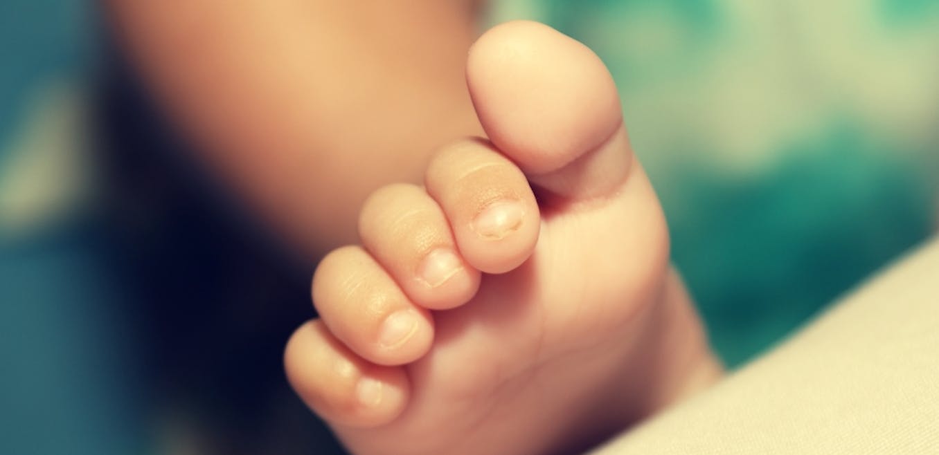 More Than 20 000 Stillbirths Worldwide Are Avoidable More Than 20 000 Stillbirths Worldwide Are Avoidable