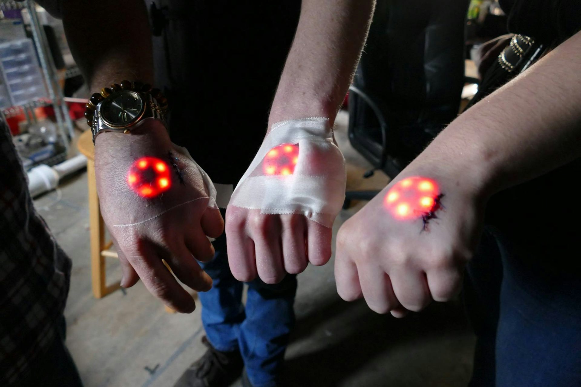 Meet the biohackers letting technology get under their skin