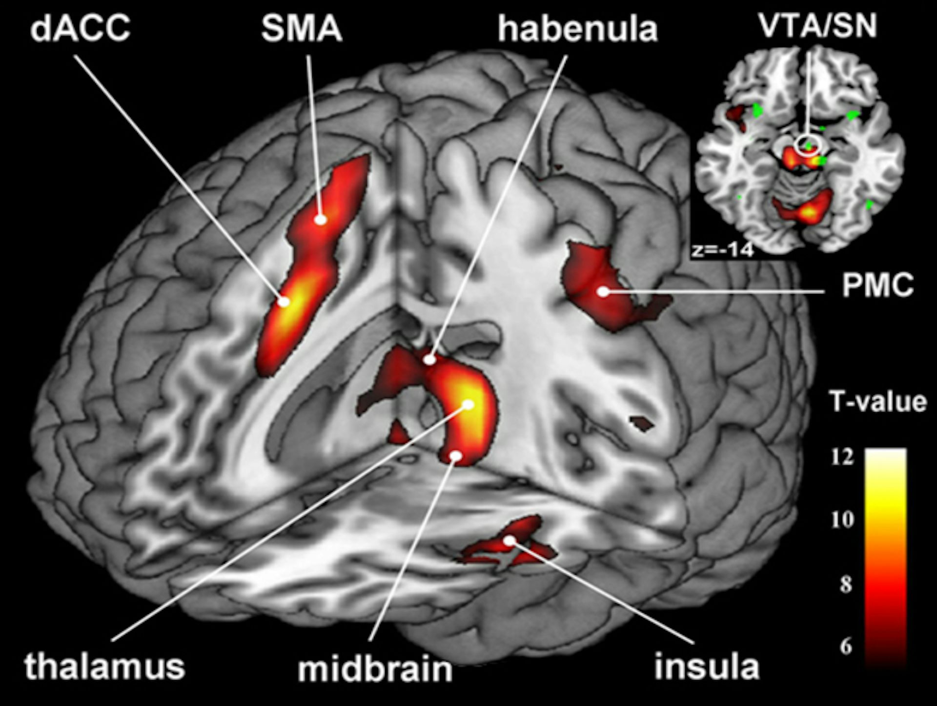 Les cinq substances les plus addictives au monde et leurs effets sur le ...