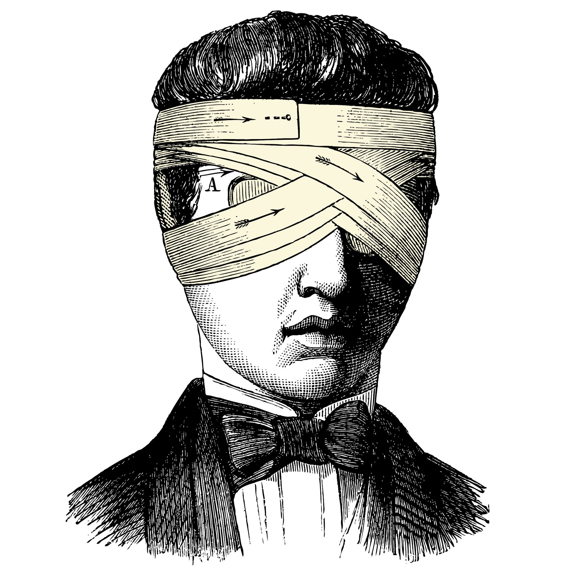 The curious origin of the double-conk theory for curing amnesia