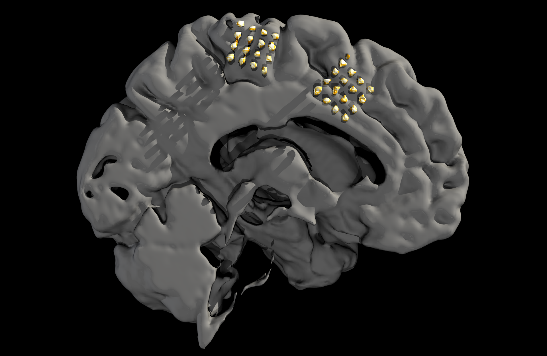 Our slow, uncertain brains are still better than computers – here’s why