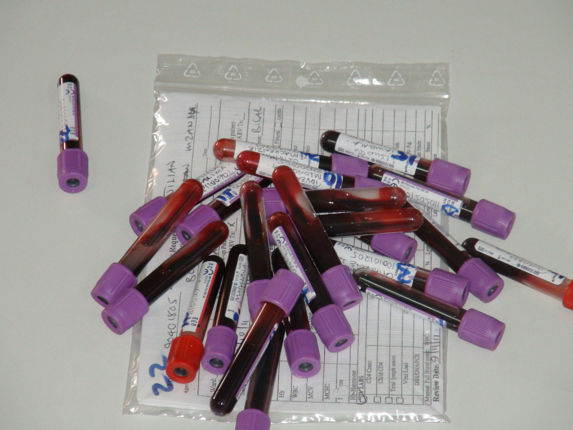 Demain, un médicament unique pour combattre les hépatites B, C et le sida