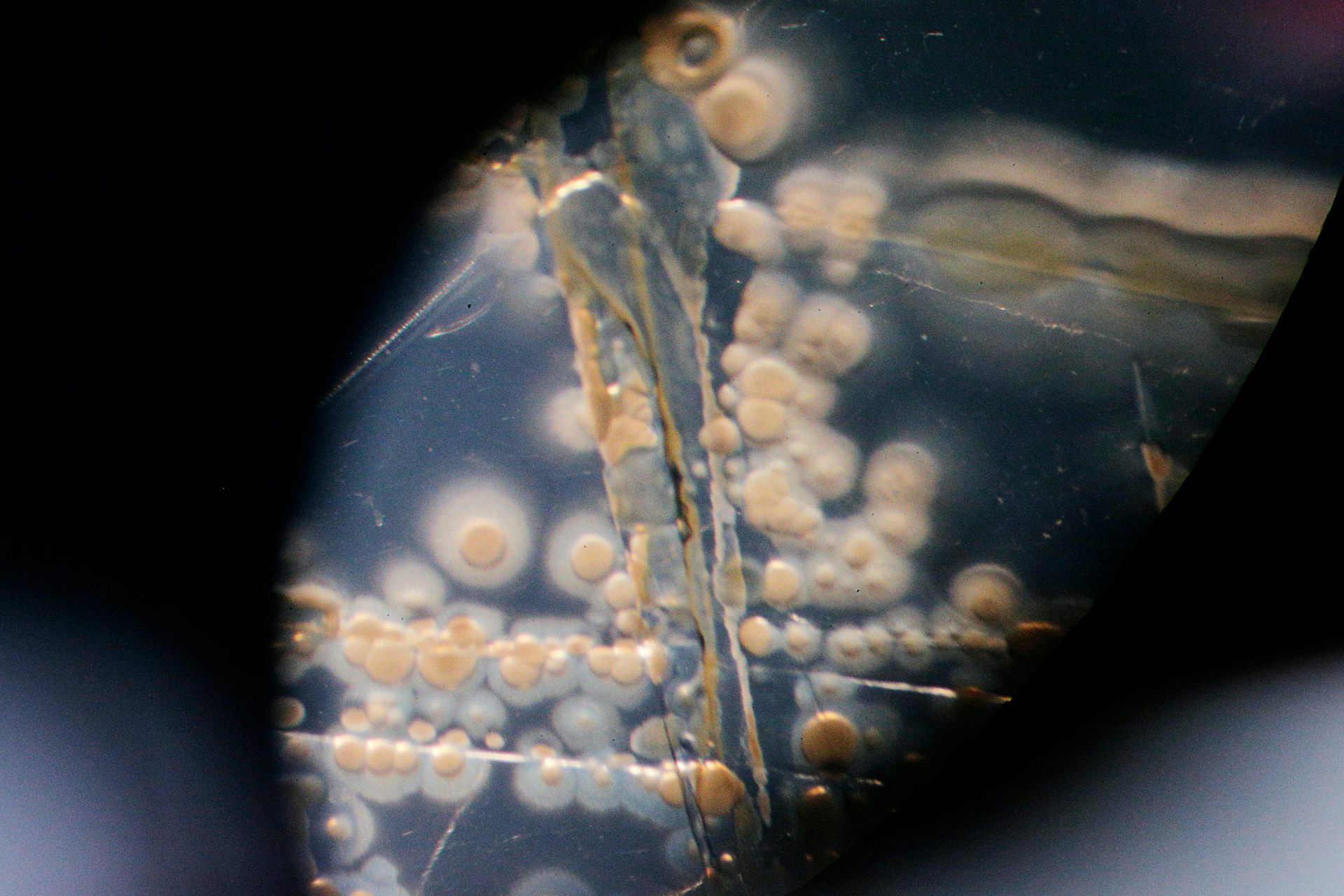 When the drugs don’t work: how we can turn the tide of antimicrobial ...