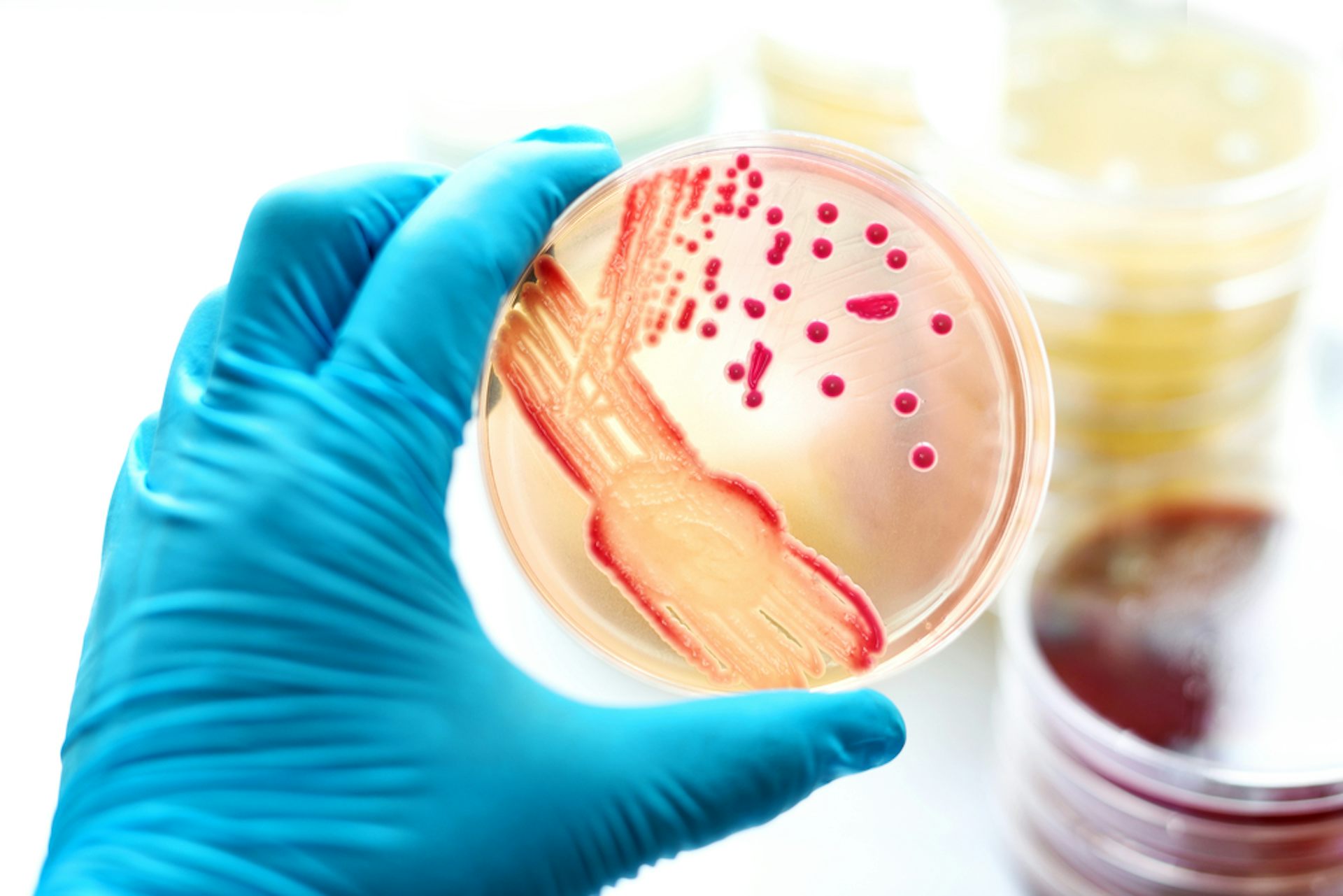 How we can use light to fight bacteria