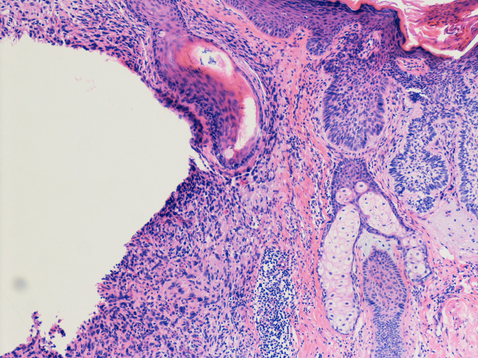 What Netflix can teach us about treating cancer