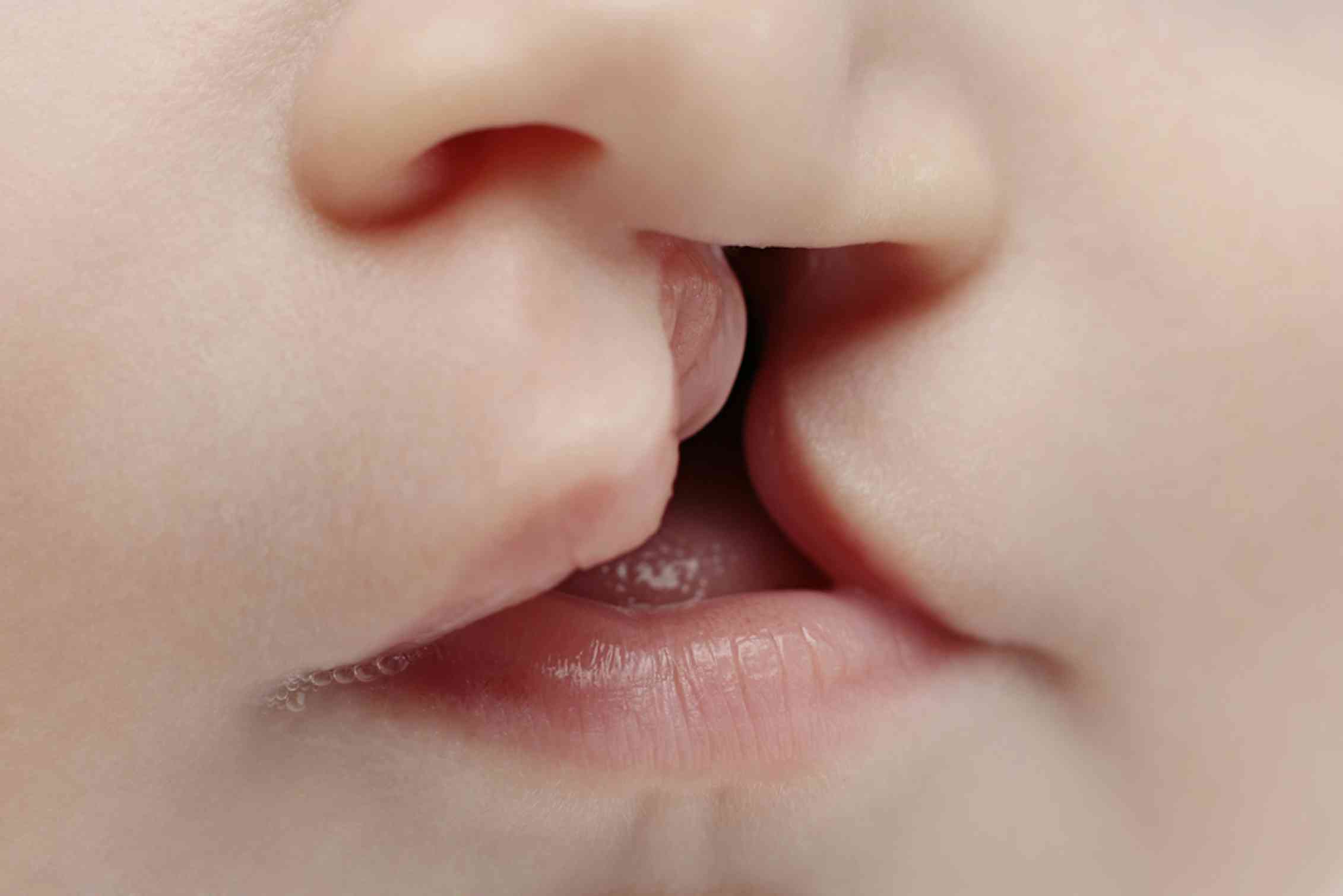 Why We Don t Know What Causes Most Birth Defects why-we-don-t-know-what-causes-most-birth-defects
