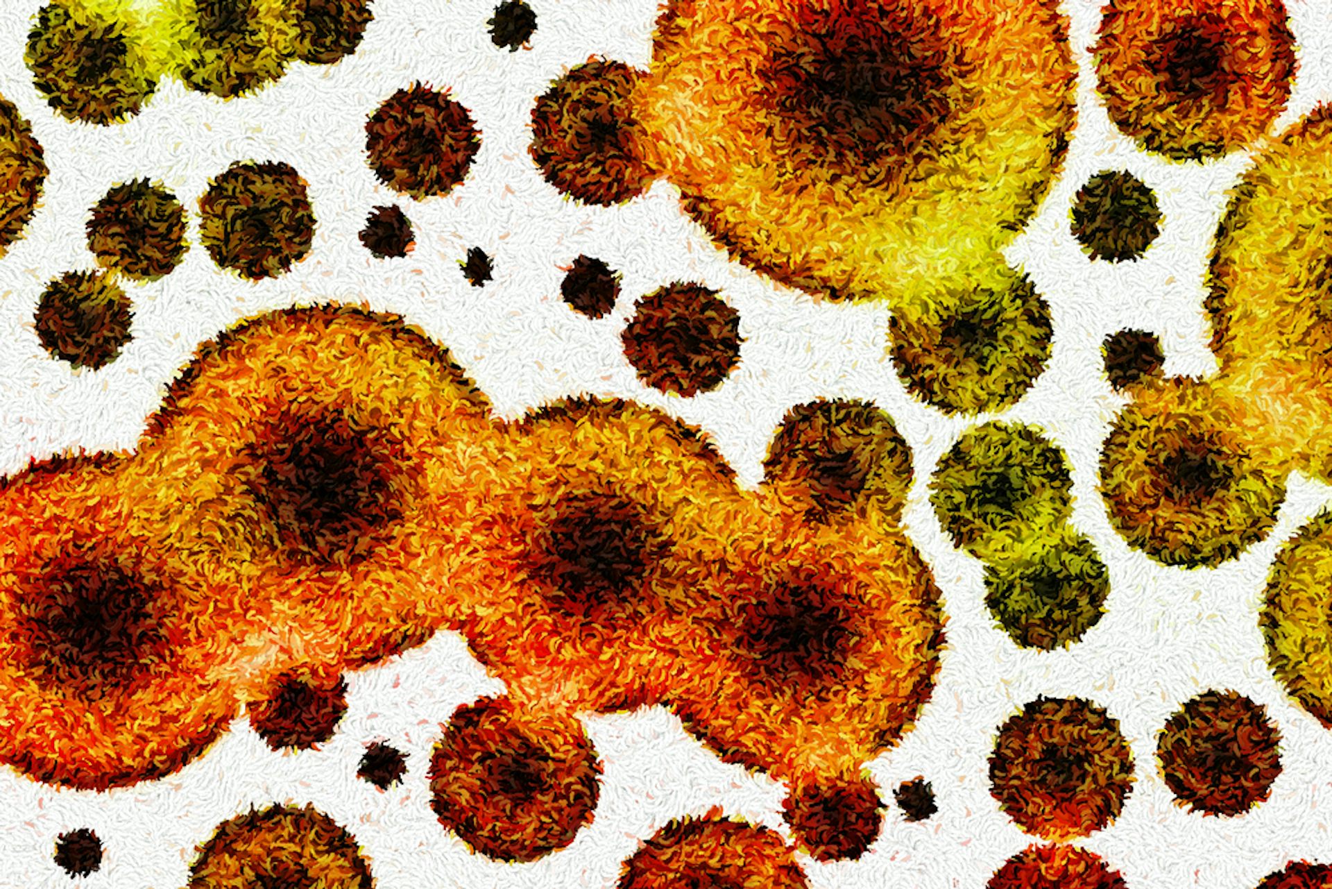 How common are superbugs in Australia, and what do we do when the ...