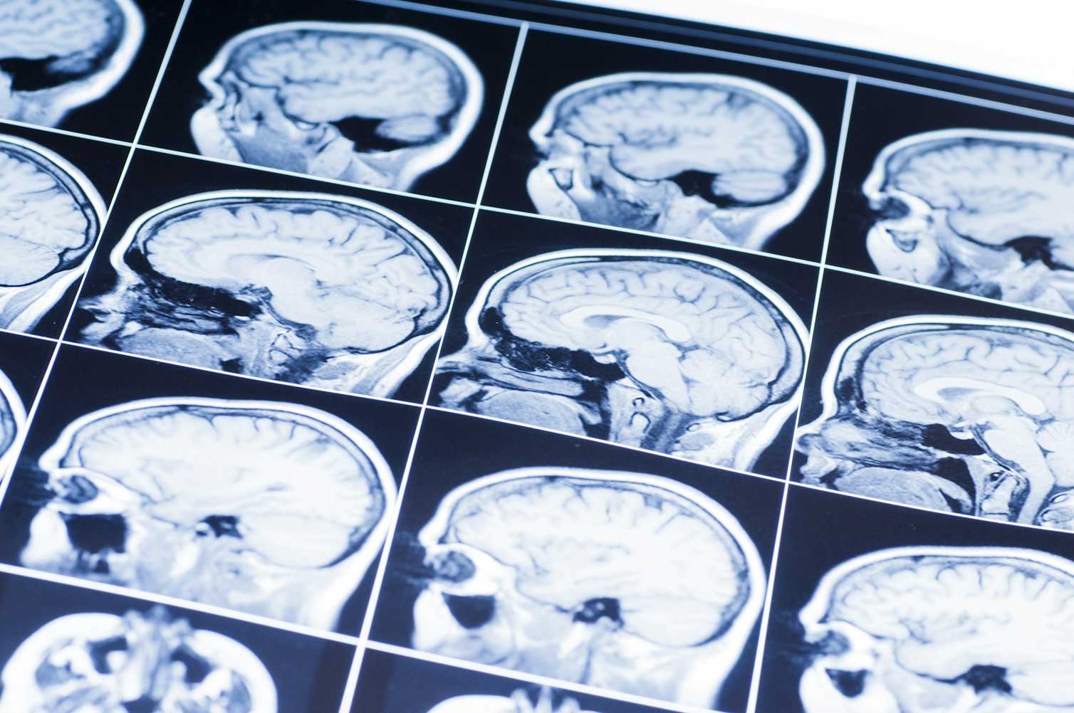 Neuroscience is unlocking mysteries of the teenage brain Neuroscience is unlocking mysteries of the teenage brain