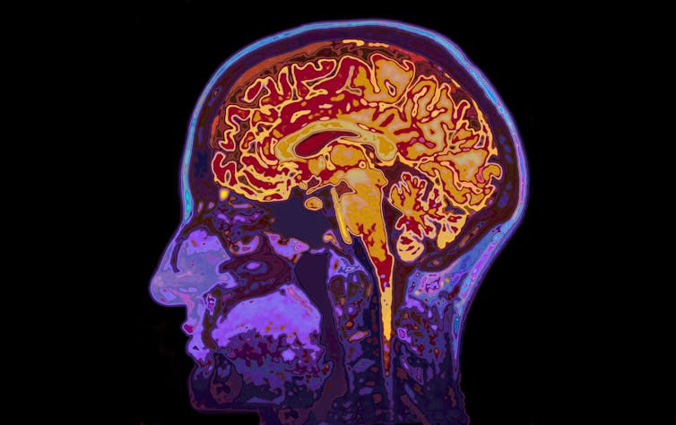 Australian Brain Alliance | Neuroscience is unlocking mysteries of the ... Australian Brain Alliance | Neuroscience is unlocking mysteries of the ...