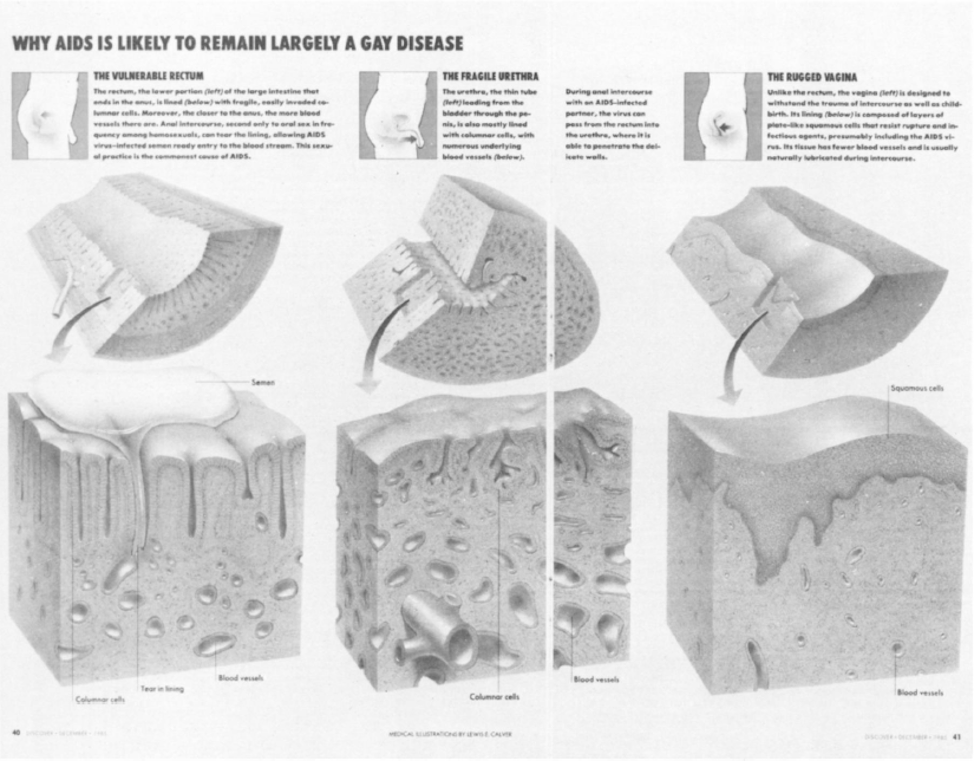 AIDS: homophobic and moralistic images of 1980s still haunt our view of ...