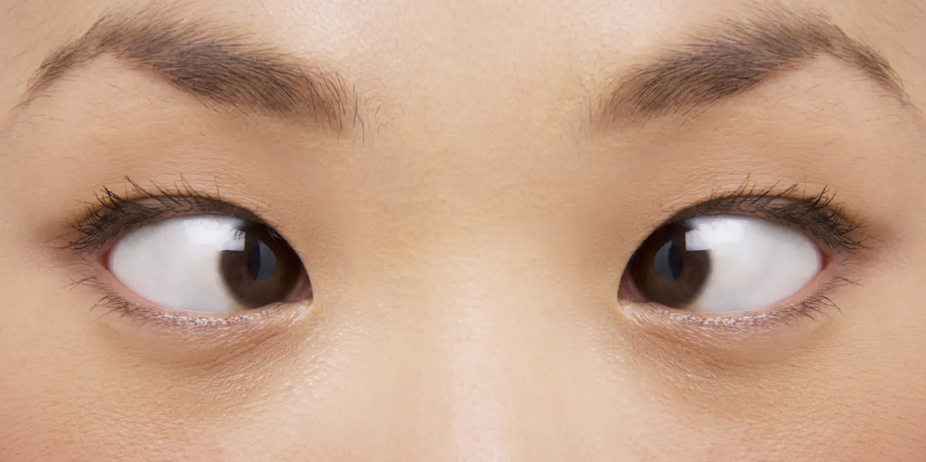 Curious Kids How Do Eyes Grow Curious Kids How Do Eyes Grow