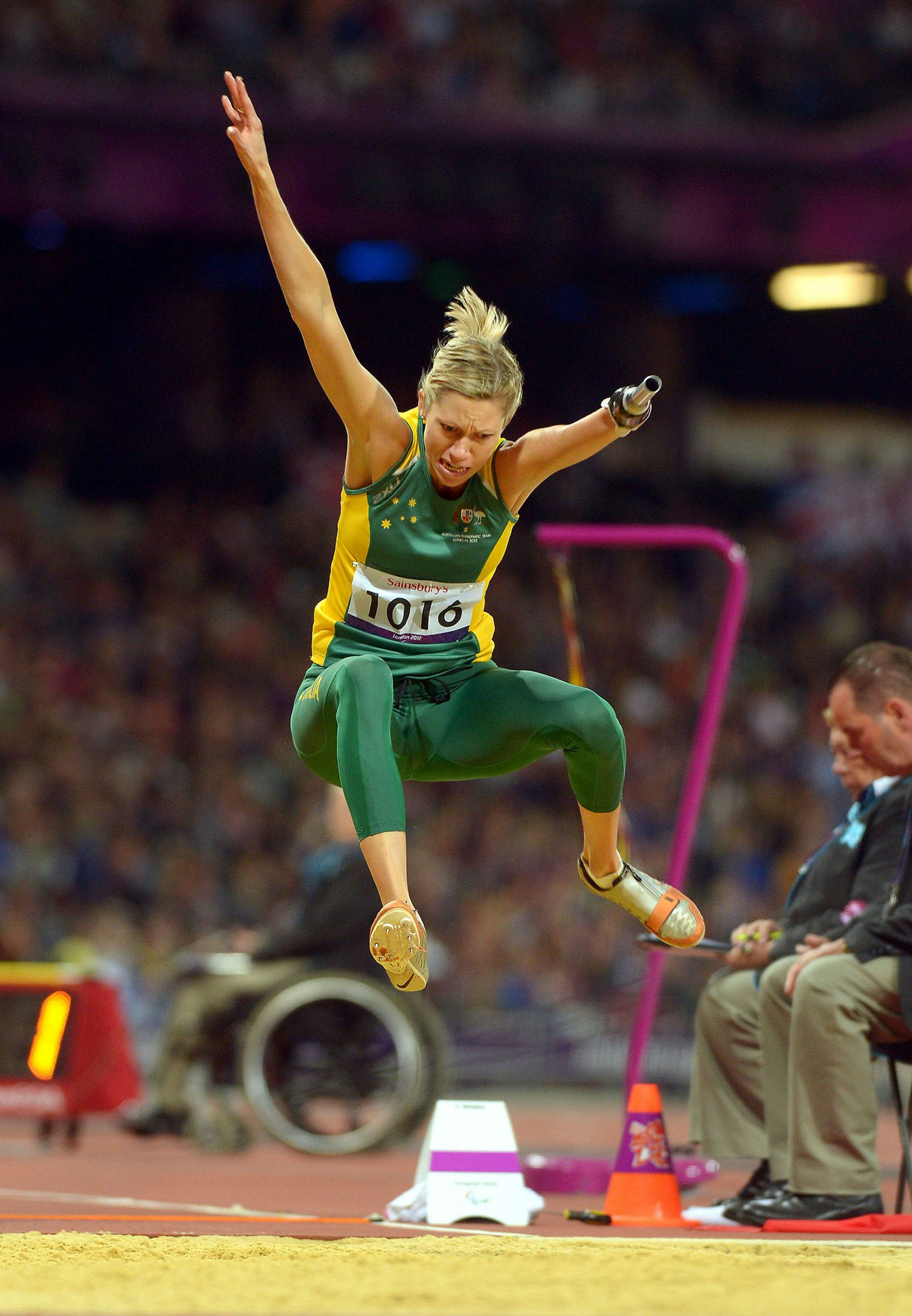 How the brain remembers amputated limbs – and continues to control them