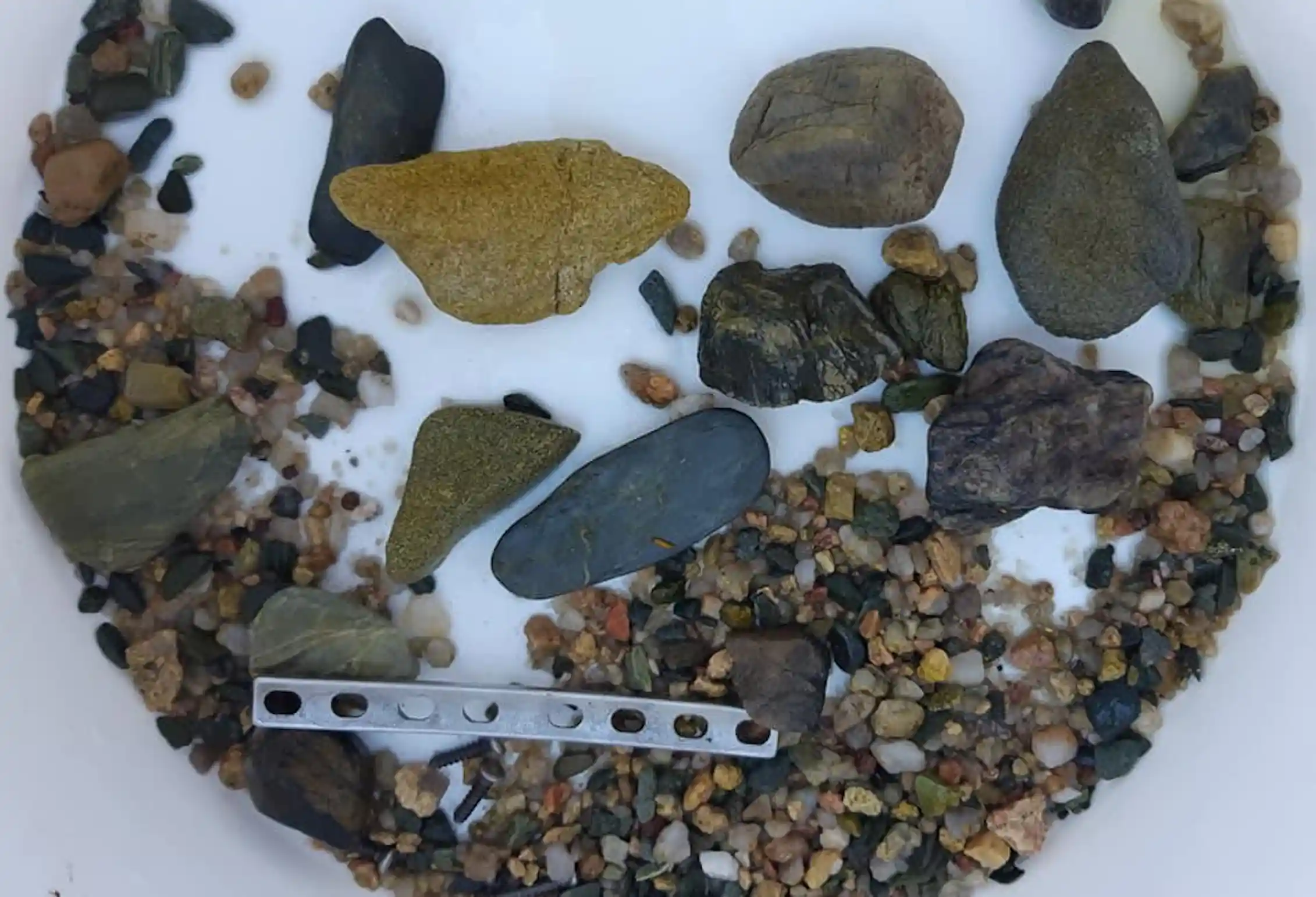 How Do We Identify Human Remains how-do-we-identify-human-remains