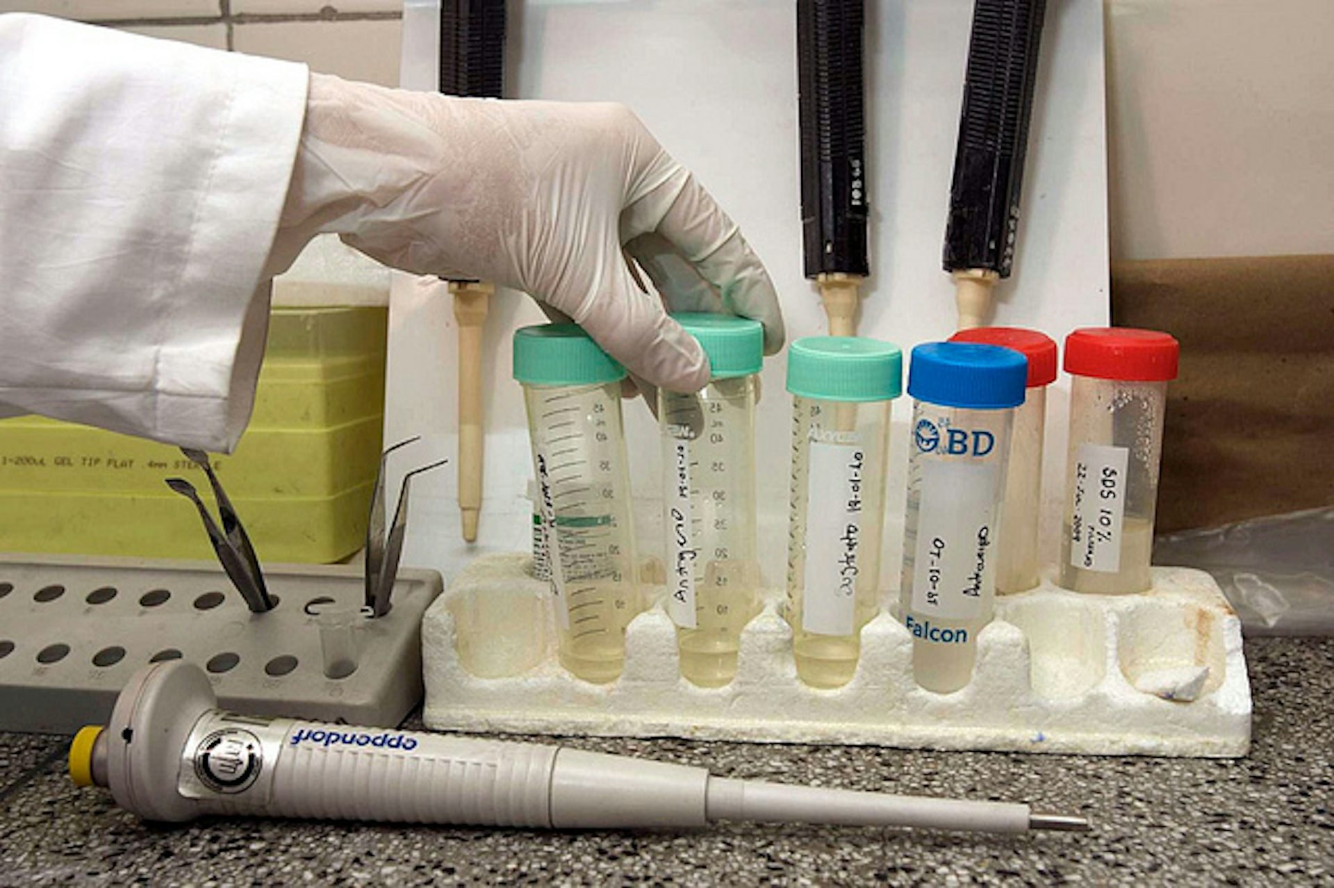 Total cancer death rate drops but progress slow on ‘forgotten cancers’