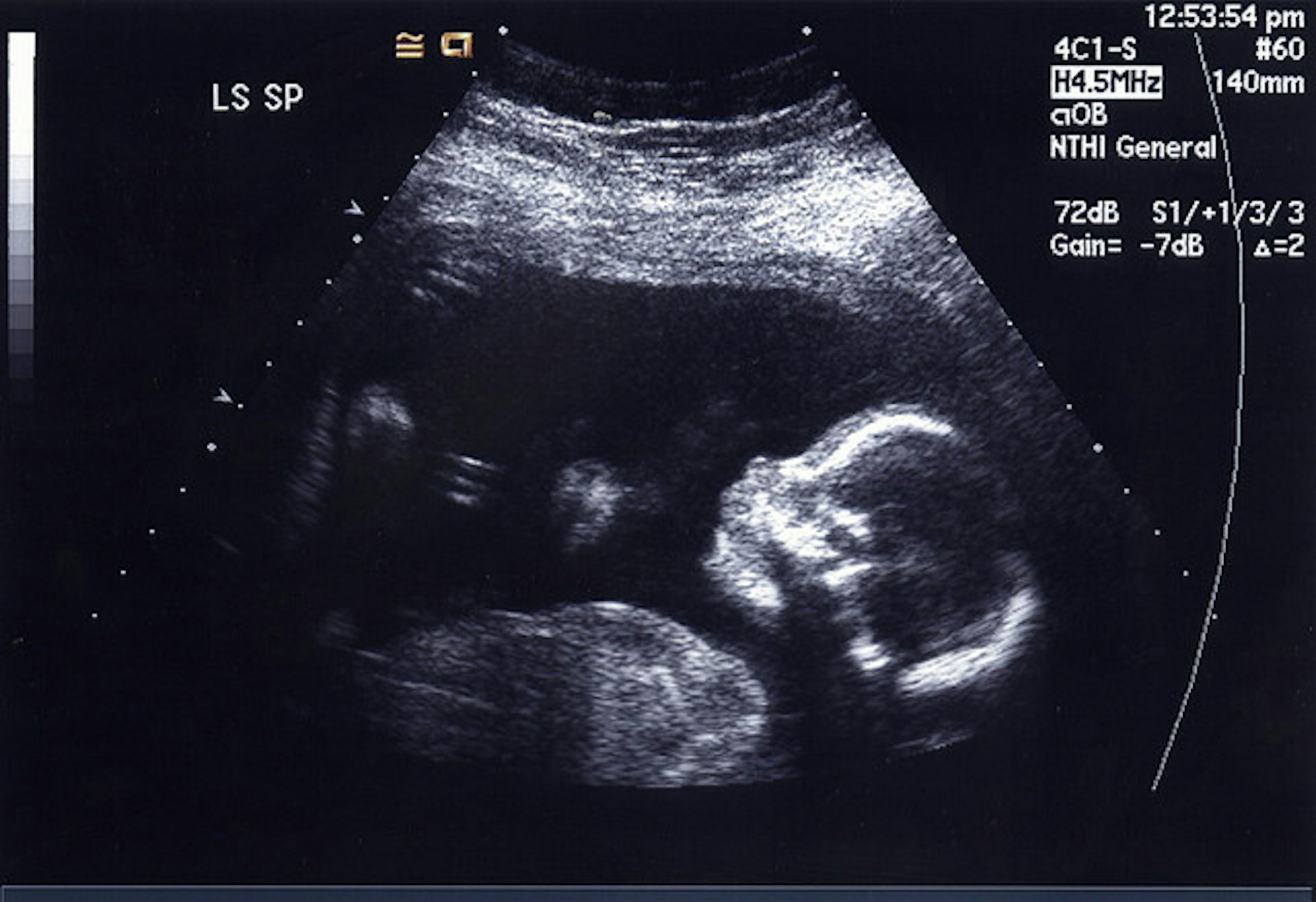 Language learning begins in the womb - Develop Us