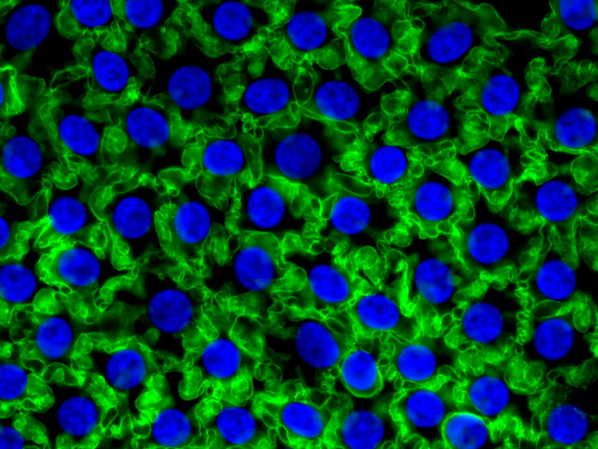 De nouvelles cibles pour les médicaments : les récepteurs membranaires ...