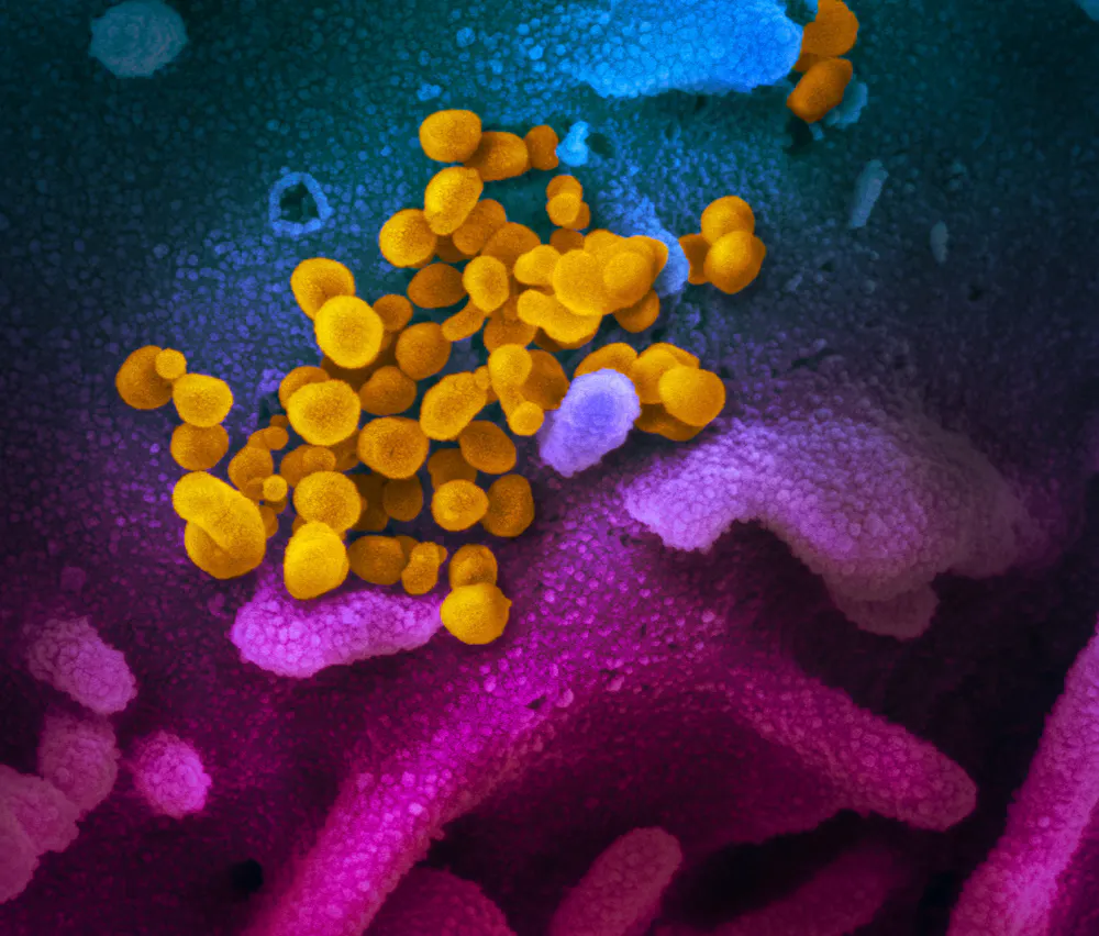 What Is A Virus How Do They Spread How Do They Make Us Sick What Is A Virus How Do They Spread How Do They Make Us Sick