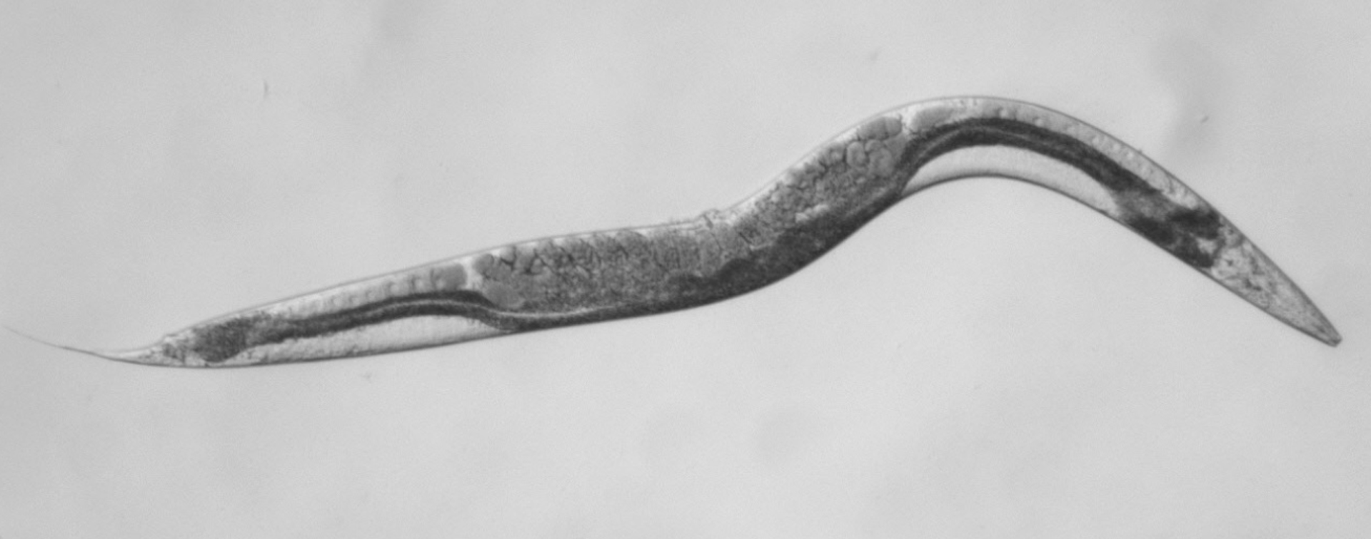How a tiny worm is helping to find a cure for an extremely rare form of ...