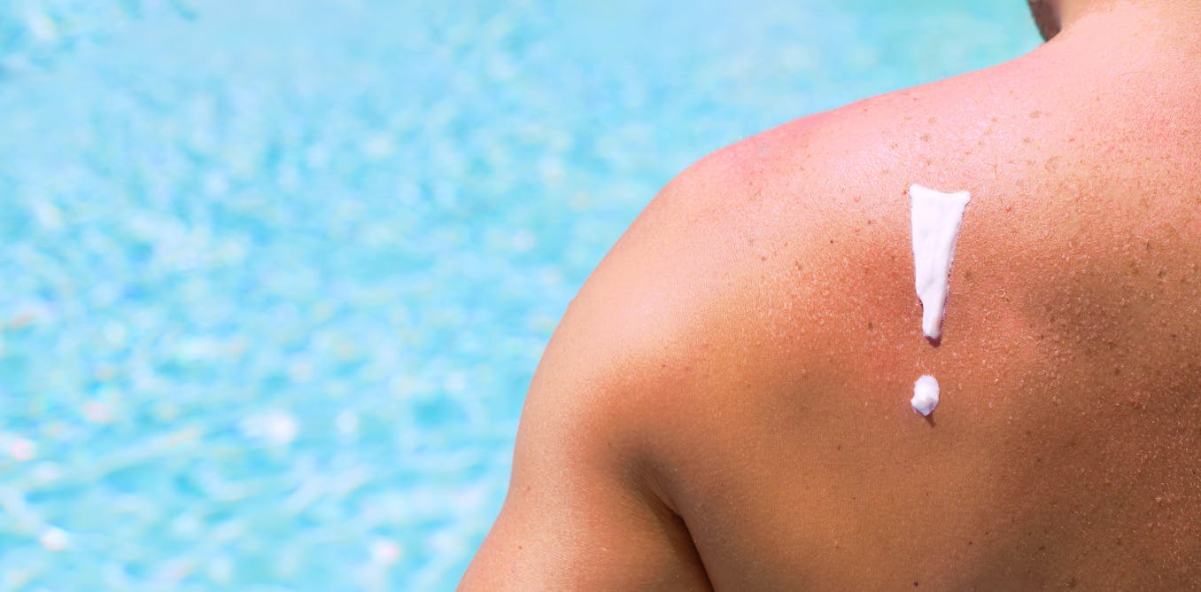 Will Skin Cancer Be The Next Big Pandemic will-skin-cancer-be-the-next-big-pandemic