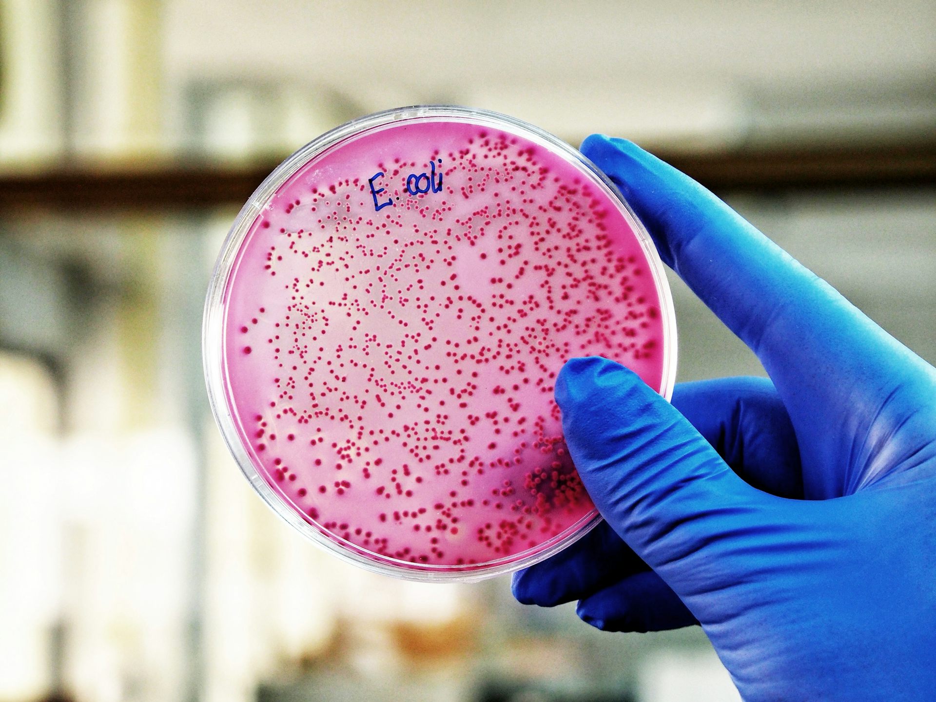 Aliments contaminés par la bactérie « E. coli » : quels effets sur la ...