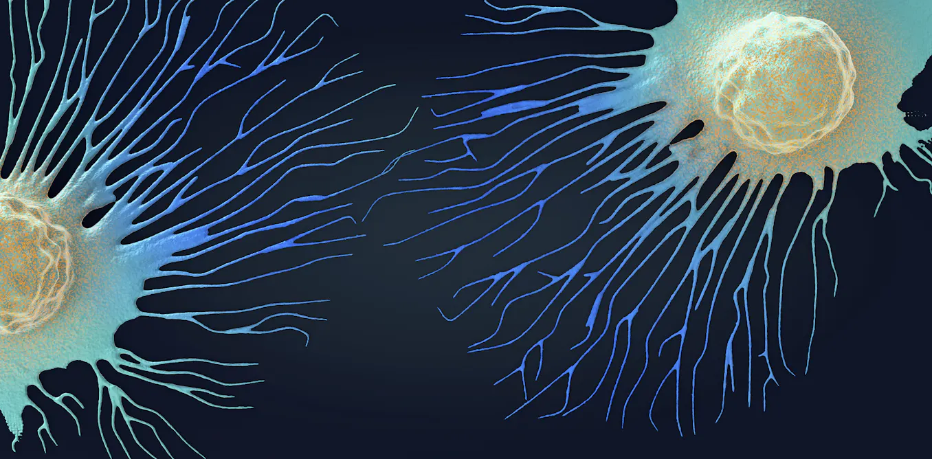 How Cancer Cells Move And Metastasize Is Influenced By The Fluids how-cancer-cells-move-and-metastasize-is-influenced-by-the-fluids