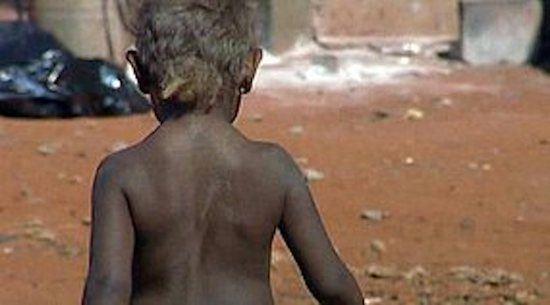 Indigenous Australia left behind in rheumatic heart disease fight