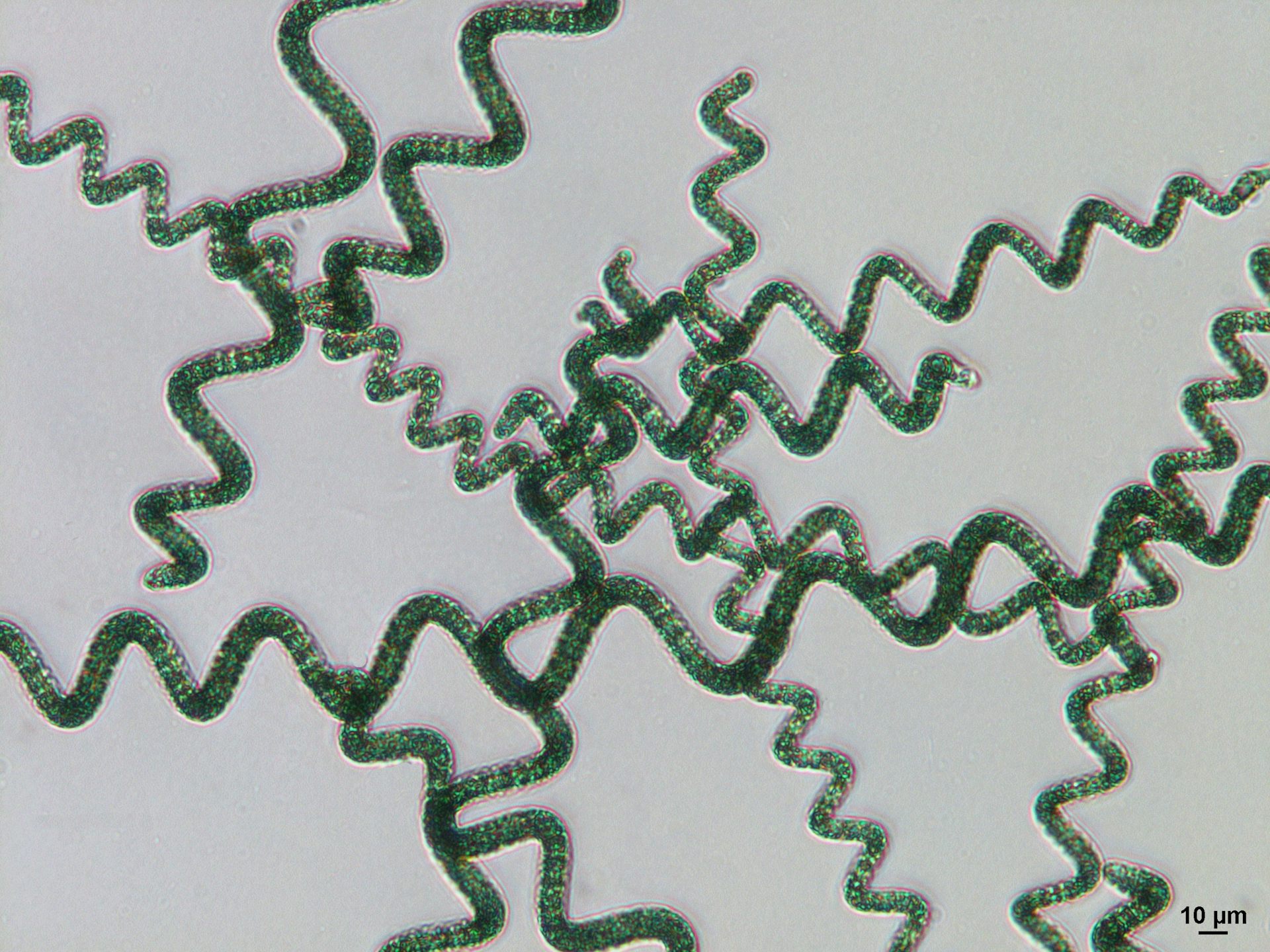 Dans les eaux de baignade, les cyanobactéries, amies ou ennemies