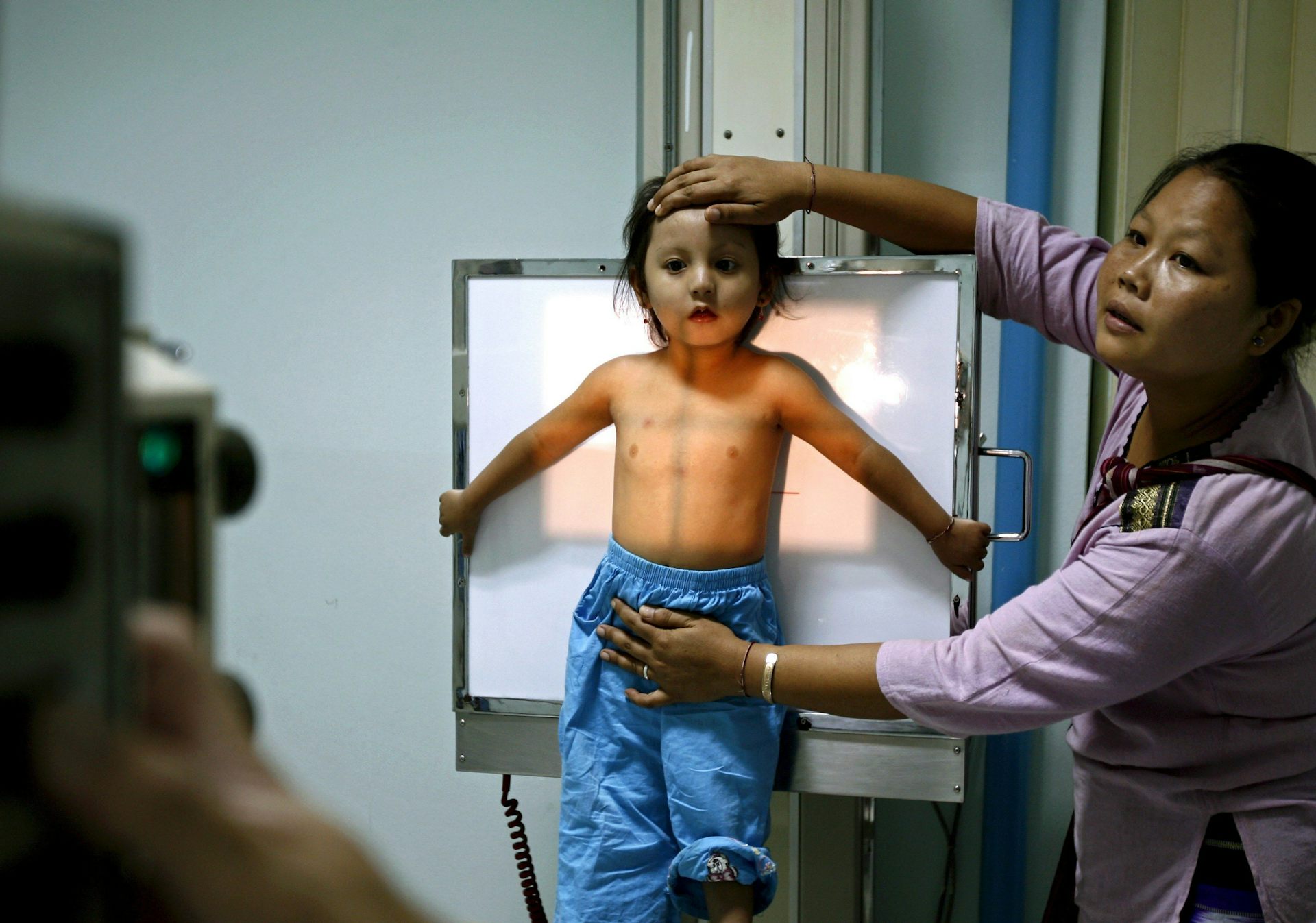 Tuberculosis breath-test could be big help, even in Australia