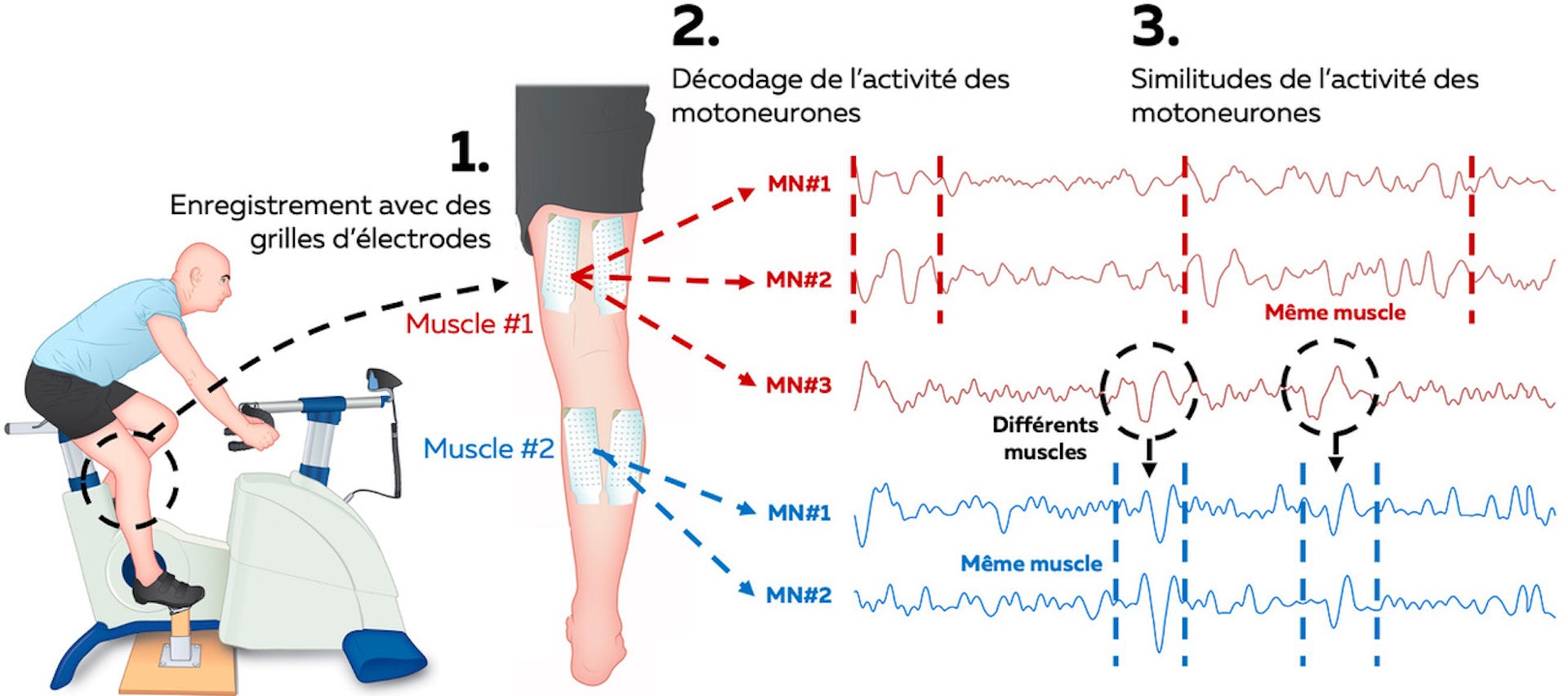 Interface cerveau-machine : utiliser nos muscles pour faire parler nos ...