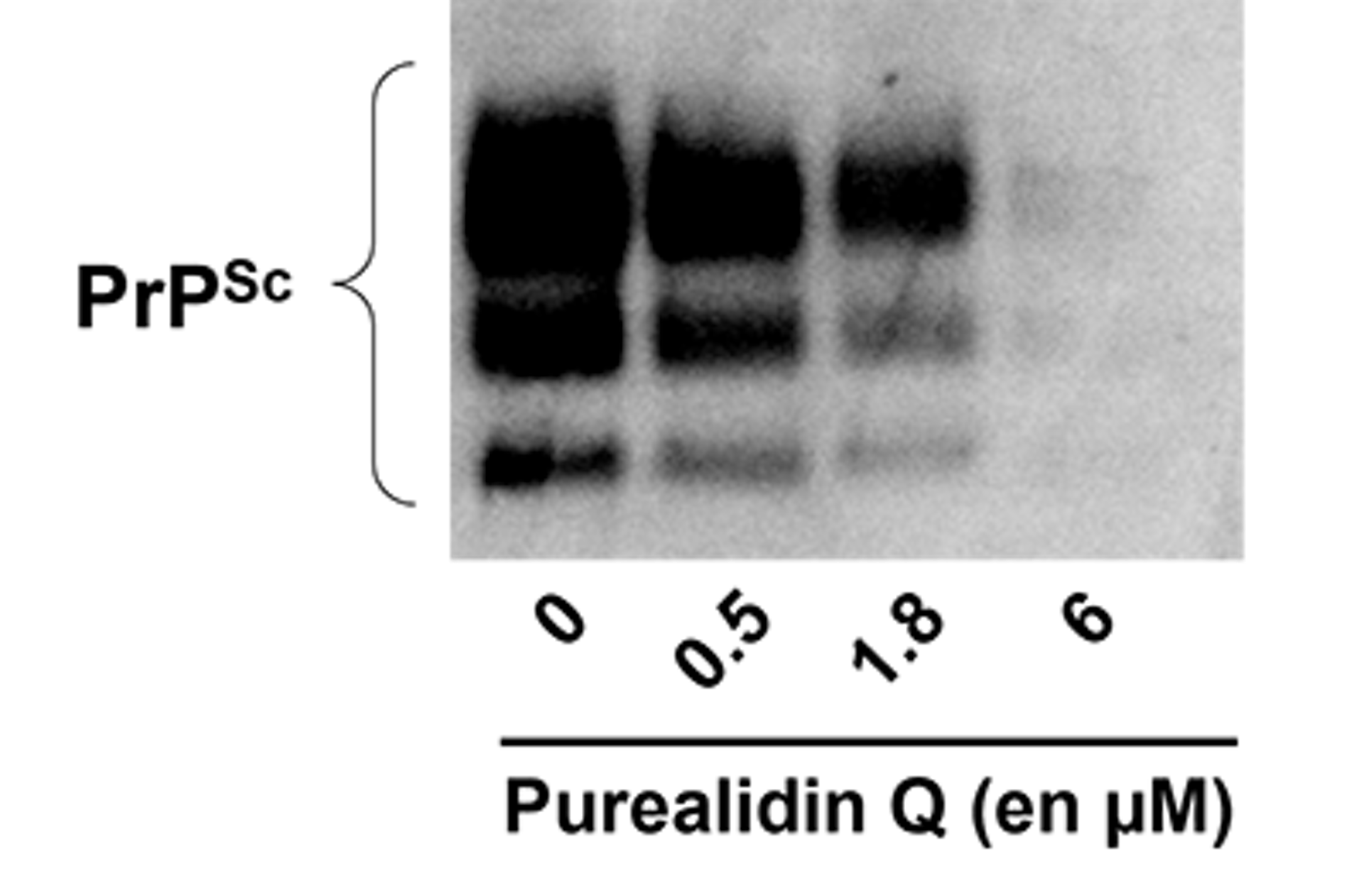 Maladies à prions : une piste thérapeutique grâce aux éponges marines