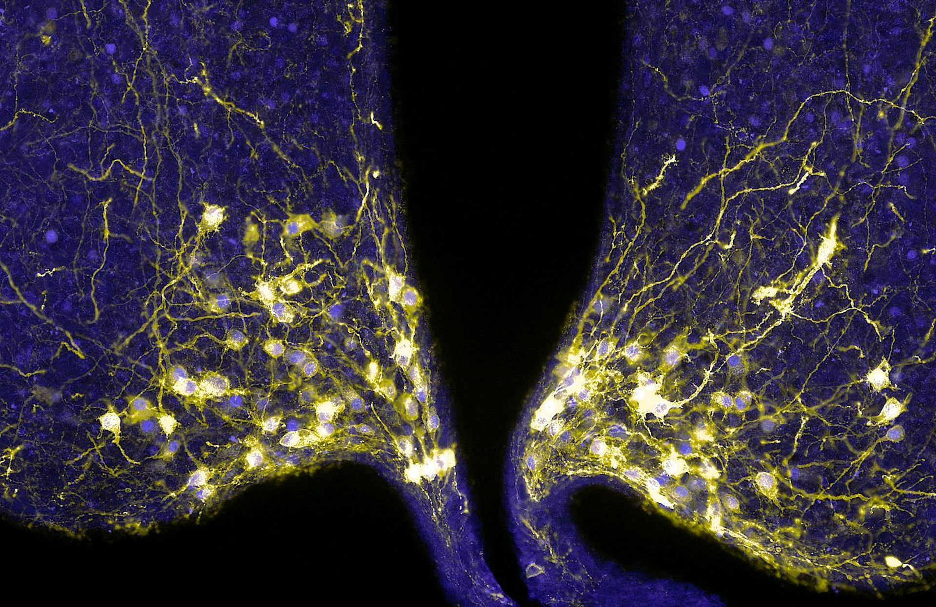 Even just thinking you’re hungry could change your immune system – new ...
