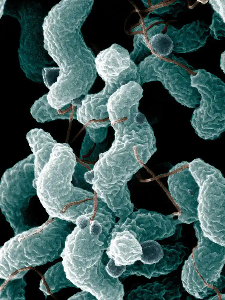 Explainer What Is Gastroenteritis And Why Can t I Get Rid Of It Explainer What Is Gastroenteritis And Why Can t I Get Rid Of It