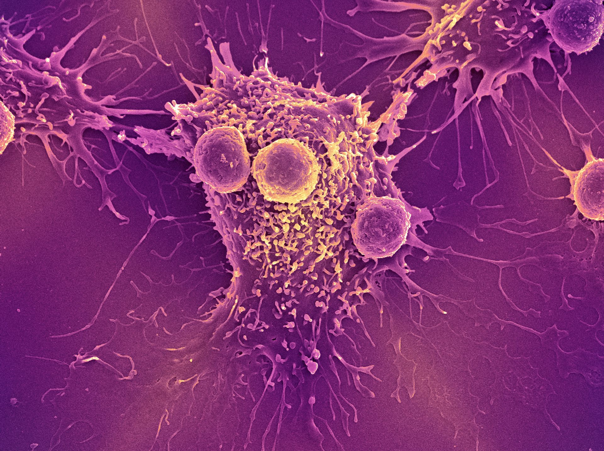 Vacinas de mRNA contra a COVID-19 podem deflagrar a próxima revolução ...