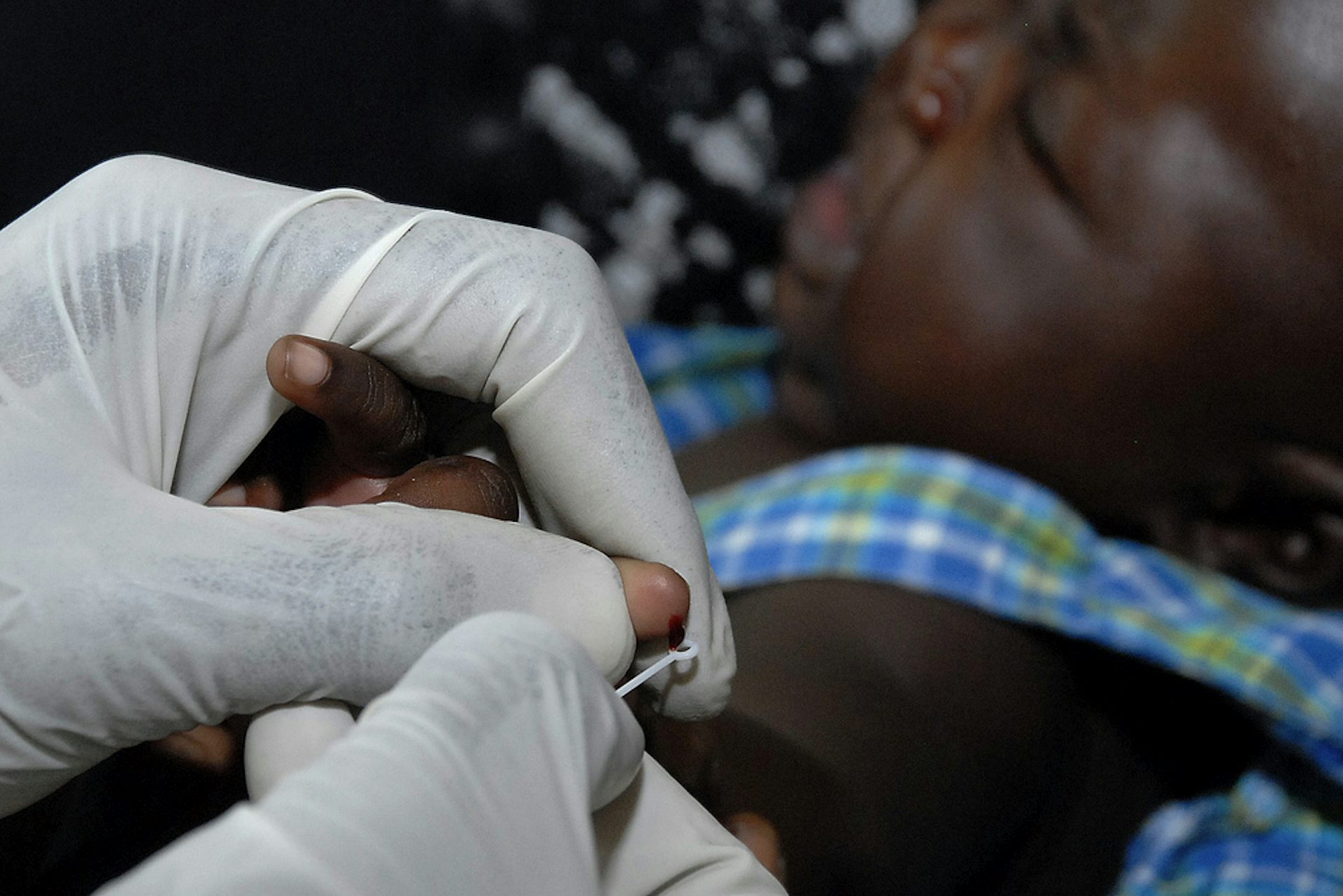 Genetically modifying parasites to find the best malaria vaccine