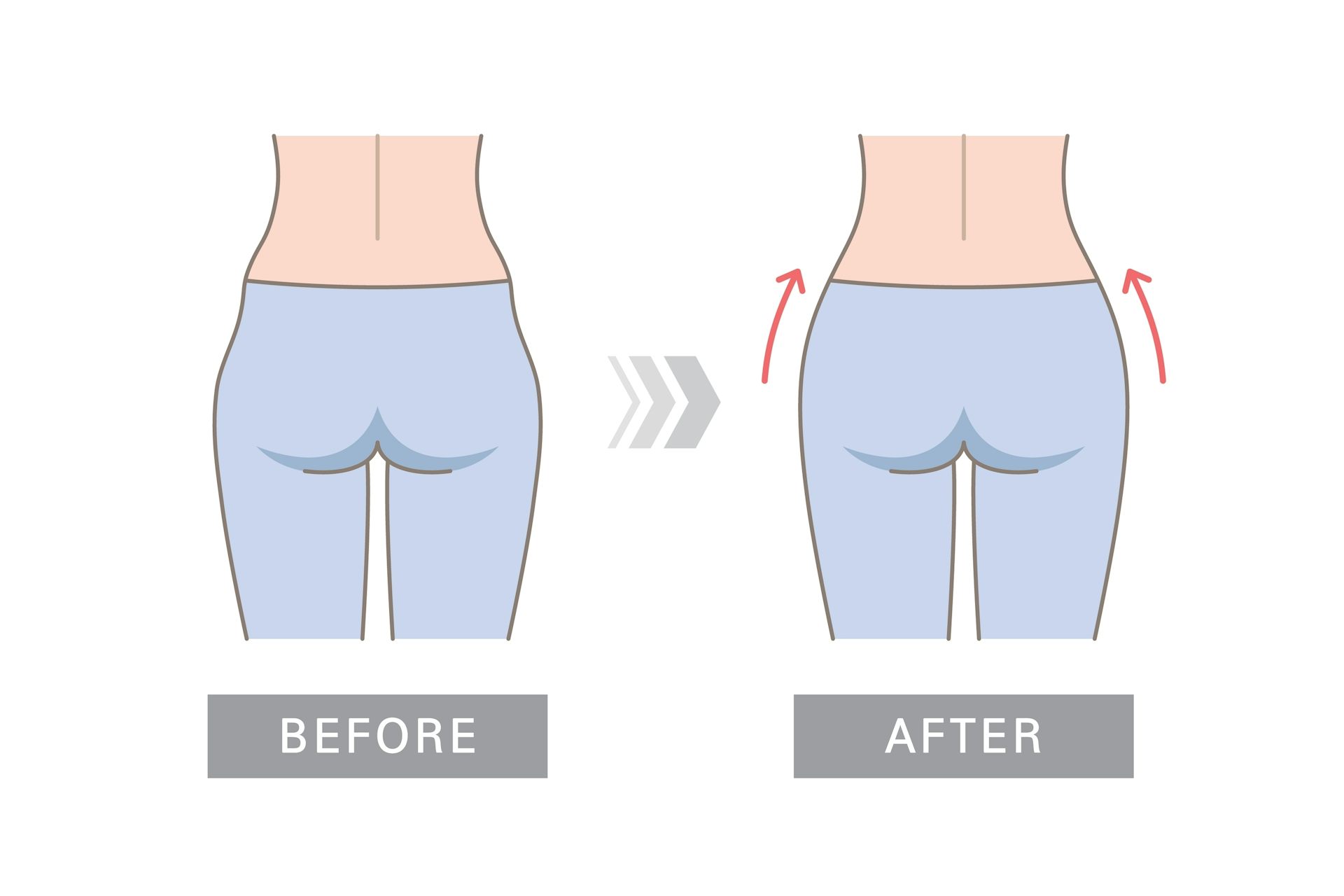 Hip Dips: What Are They And Can You Really Get Rid Of Them? | MiNDFOOD