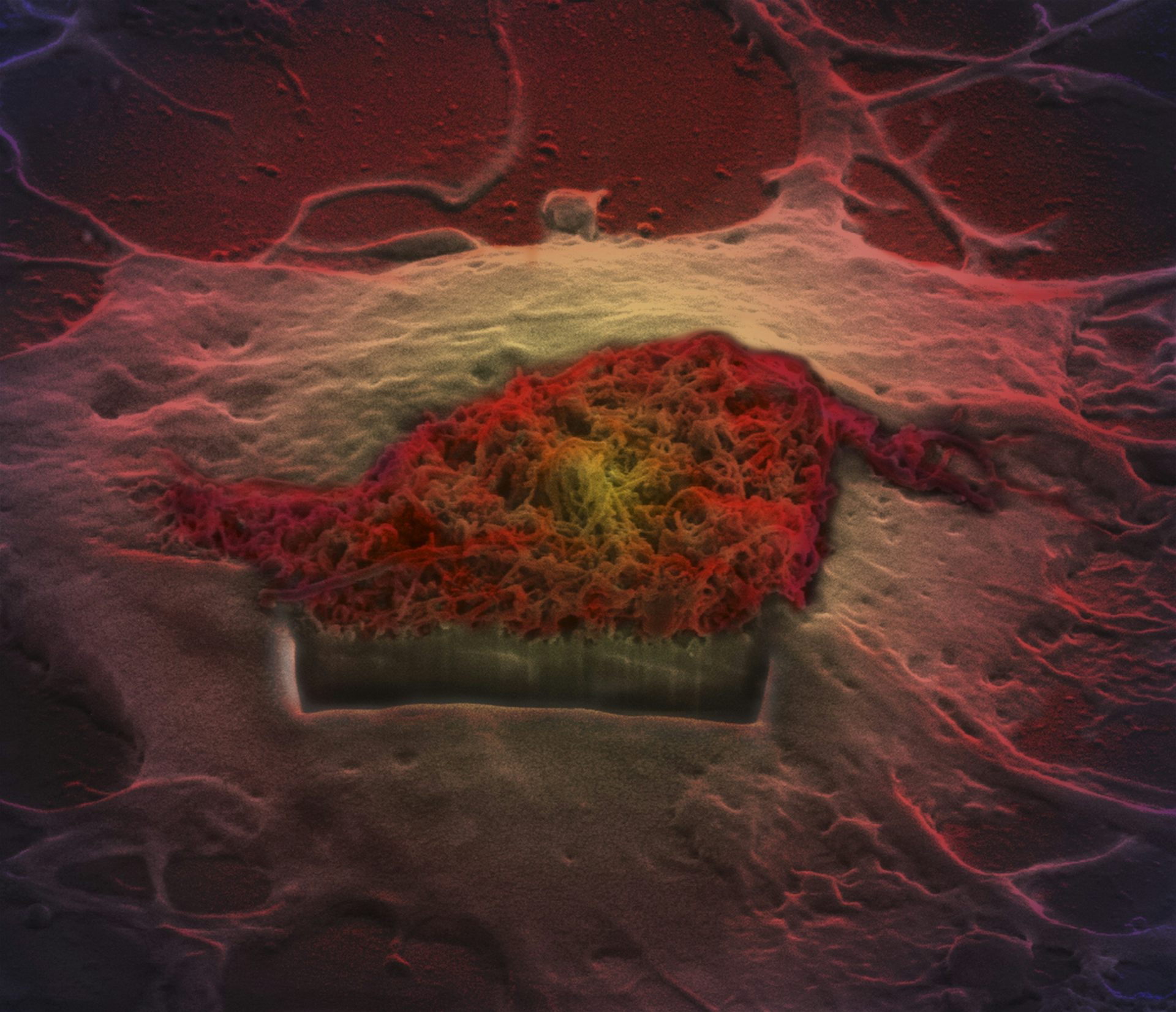 Slowdown of brain’s waste removal system could drive Alzheimer’s