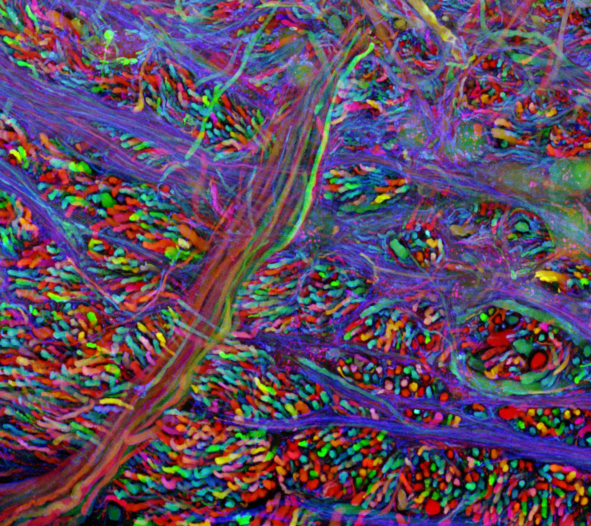 Fluorescent proteins light up science by making the invisible visible