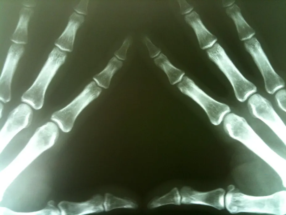 Brainy Bones The Hidden Complexity Inside Your Skeleton Brainy Bones The Hidden Complexity Inside Your Skeleton