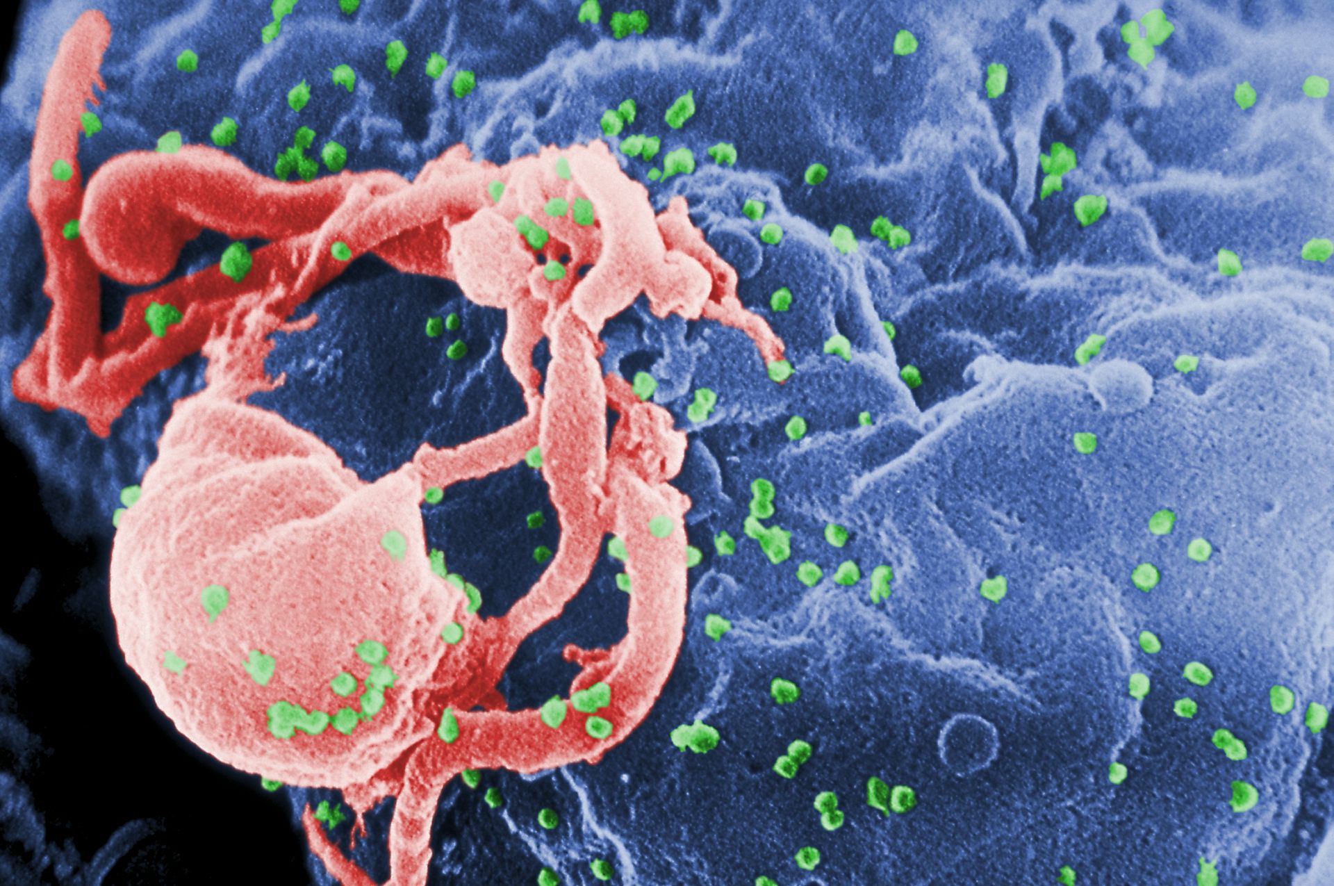 HIV bolts past immune defences despite humble beginnings