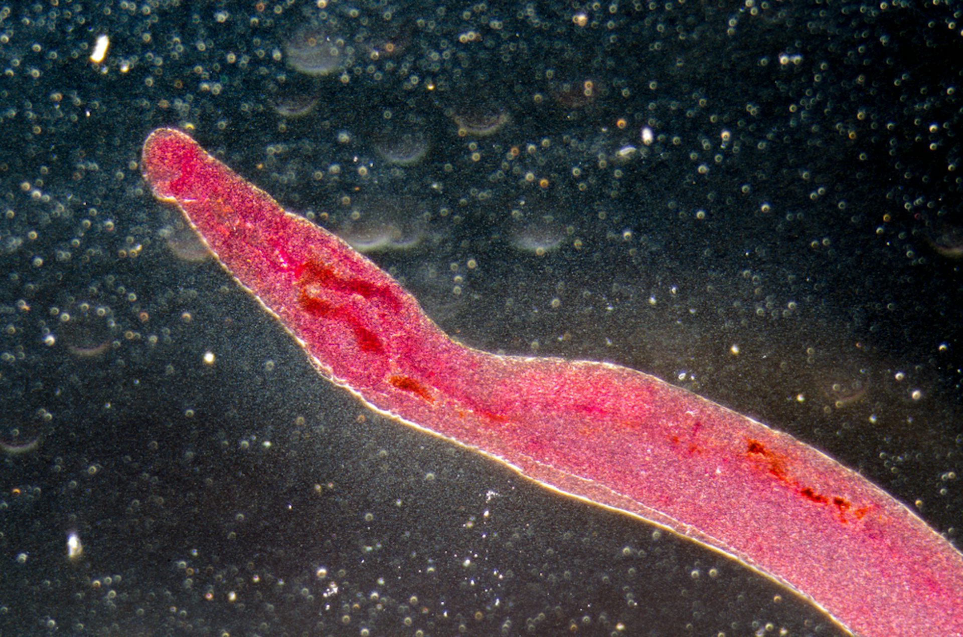Tropical worms: they infect a third of the planet, so why aren't we ...