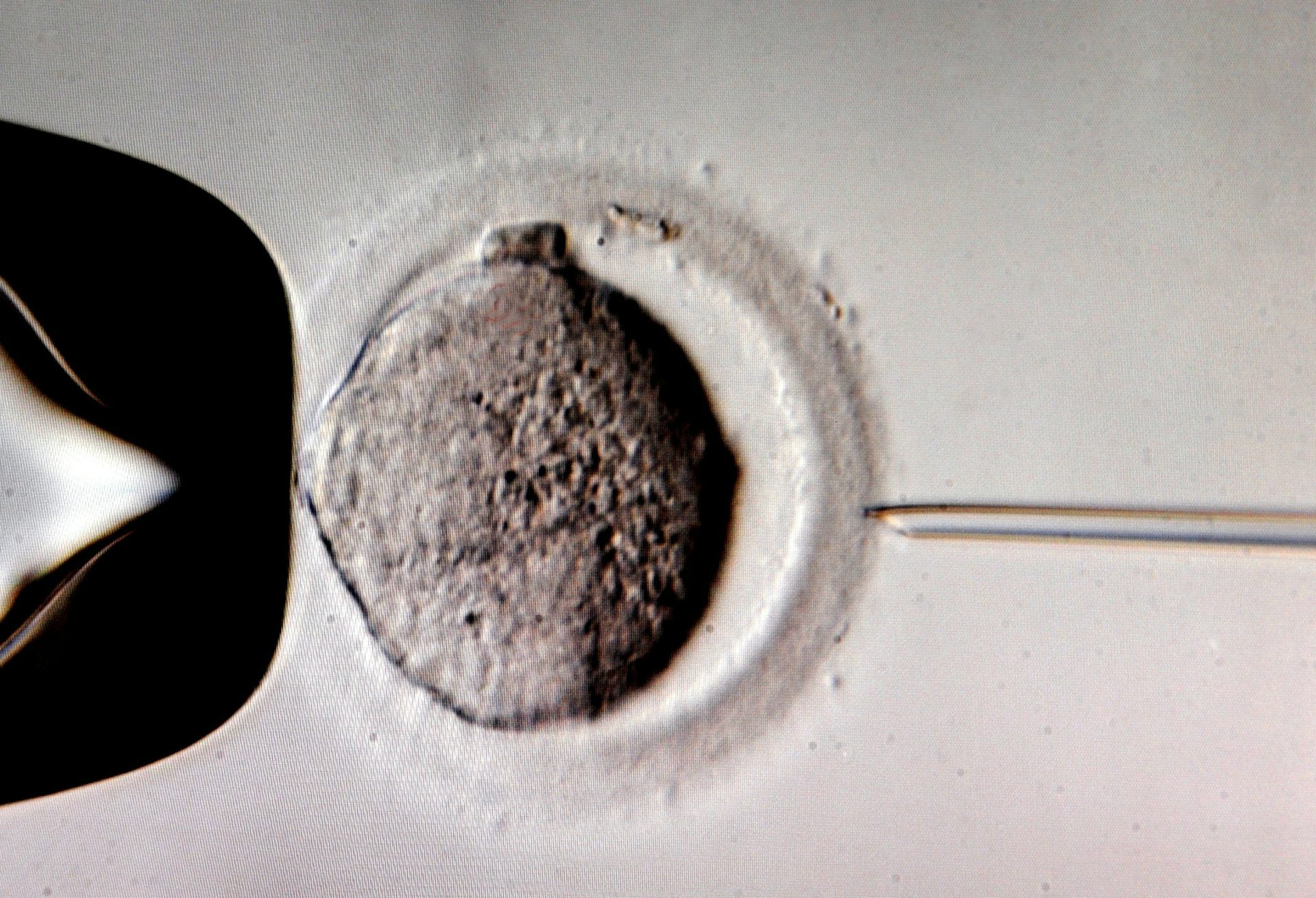 IVF babies at greater risk of heart problems in later life